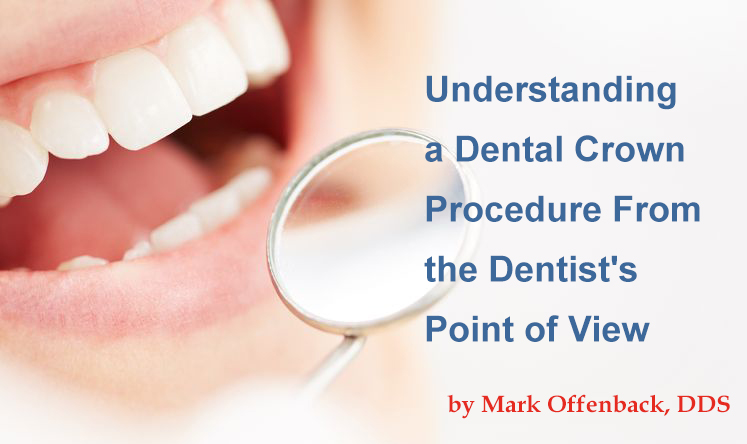 Understanding a Dental Crown Procedure From the Dentist's Point of View