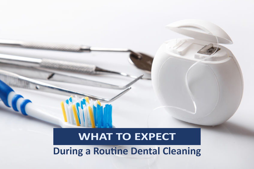 What to Expect During a Routine Dental Cleaning